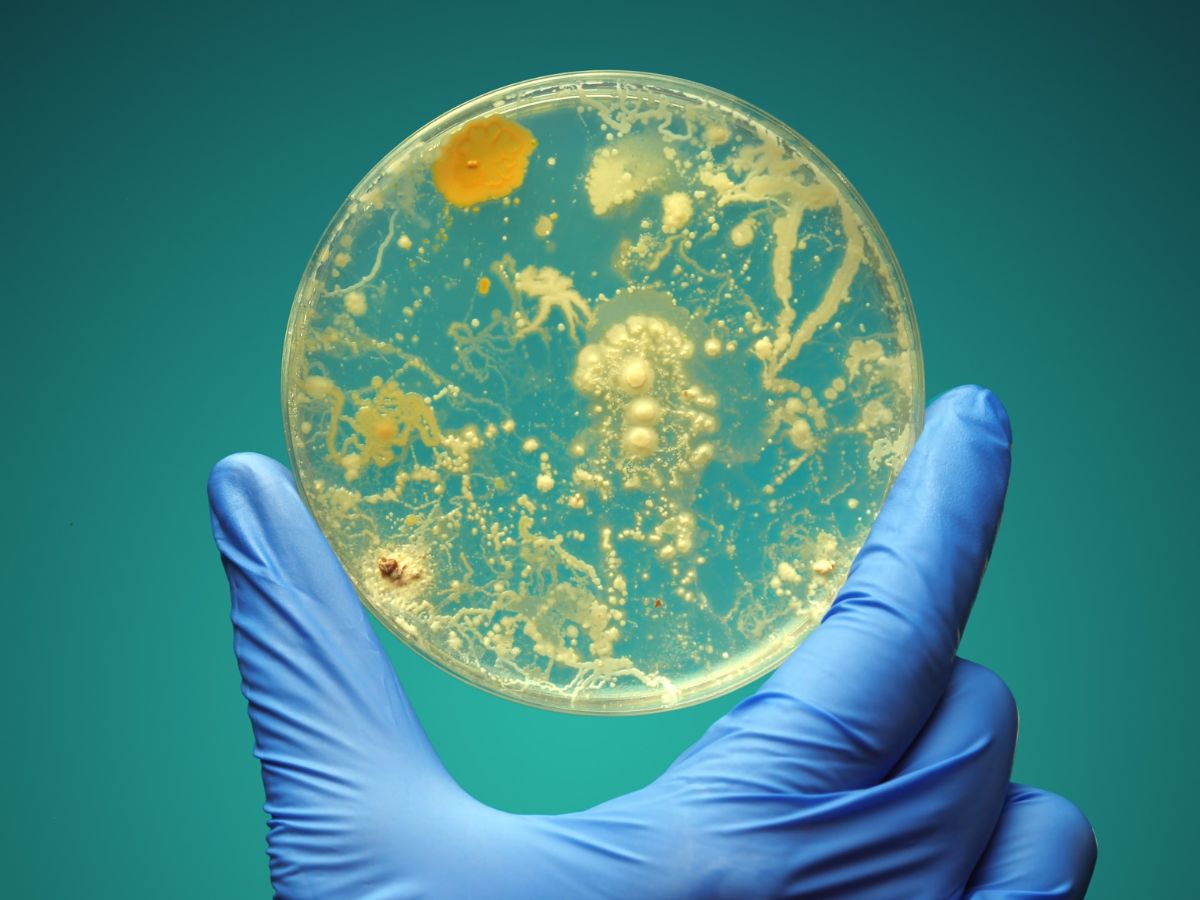 USP and : The Future of Risk-Based Bioburden Testing Standards ...